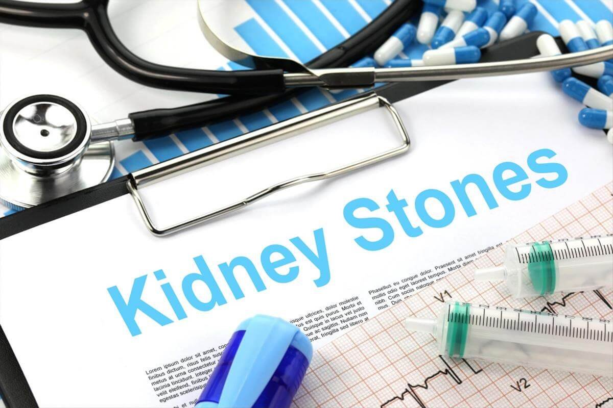 The Best Guide Passing Kidney Stones Symptoms 2026