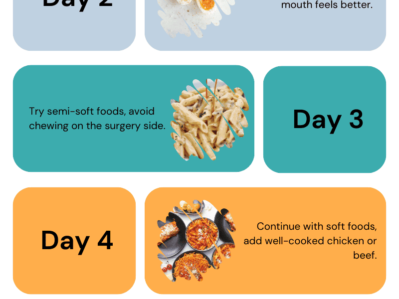 What To Eat After Wisdom Teeth Surgery Best Soft Foods Media BBC